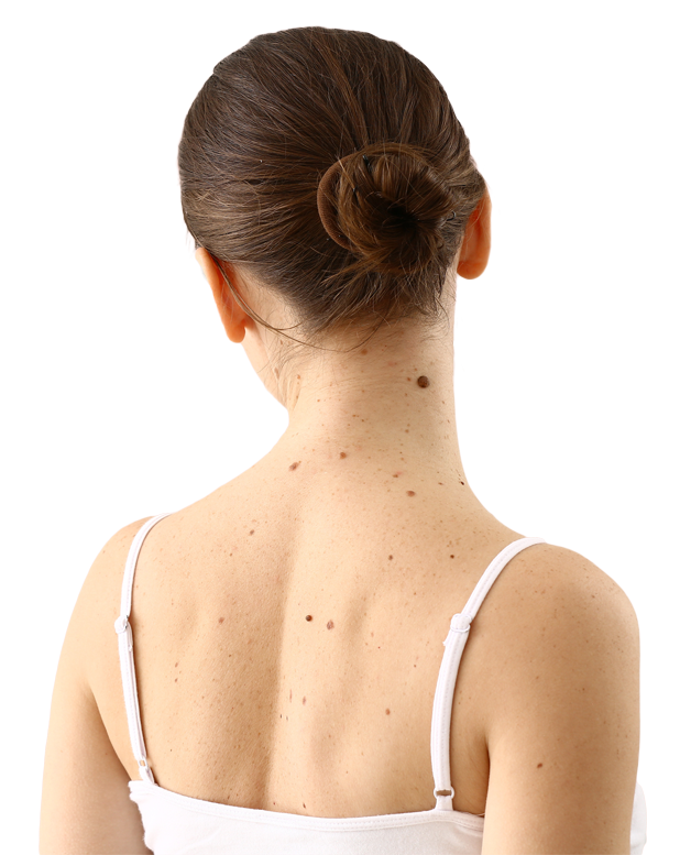 Skin Chx | Affordable Skin Cancer Screening in Perth